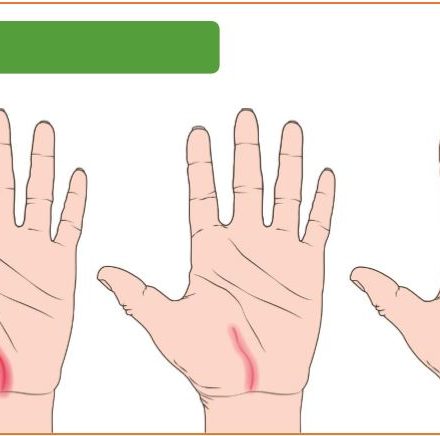 East Bay Hand Medical Center - Best Hand Surgeons