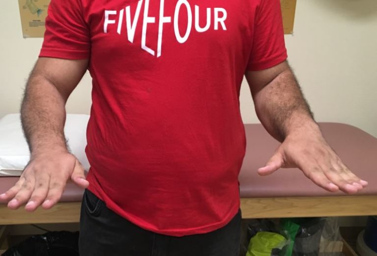 Radius Shaft Fracture ORIF – Expert Hand Surgeons in the East Bay